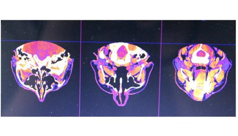 Image-Guided Endoscopic Sinus Surgery - Sinus Surgery Center | UCI ENT ...